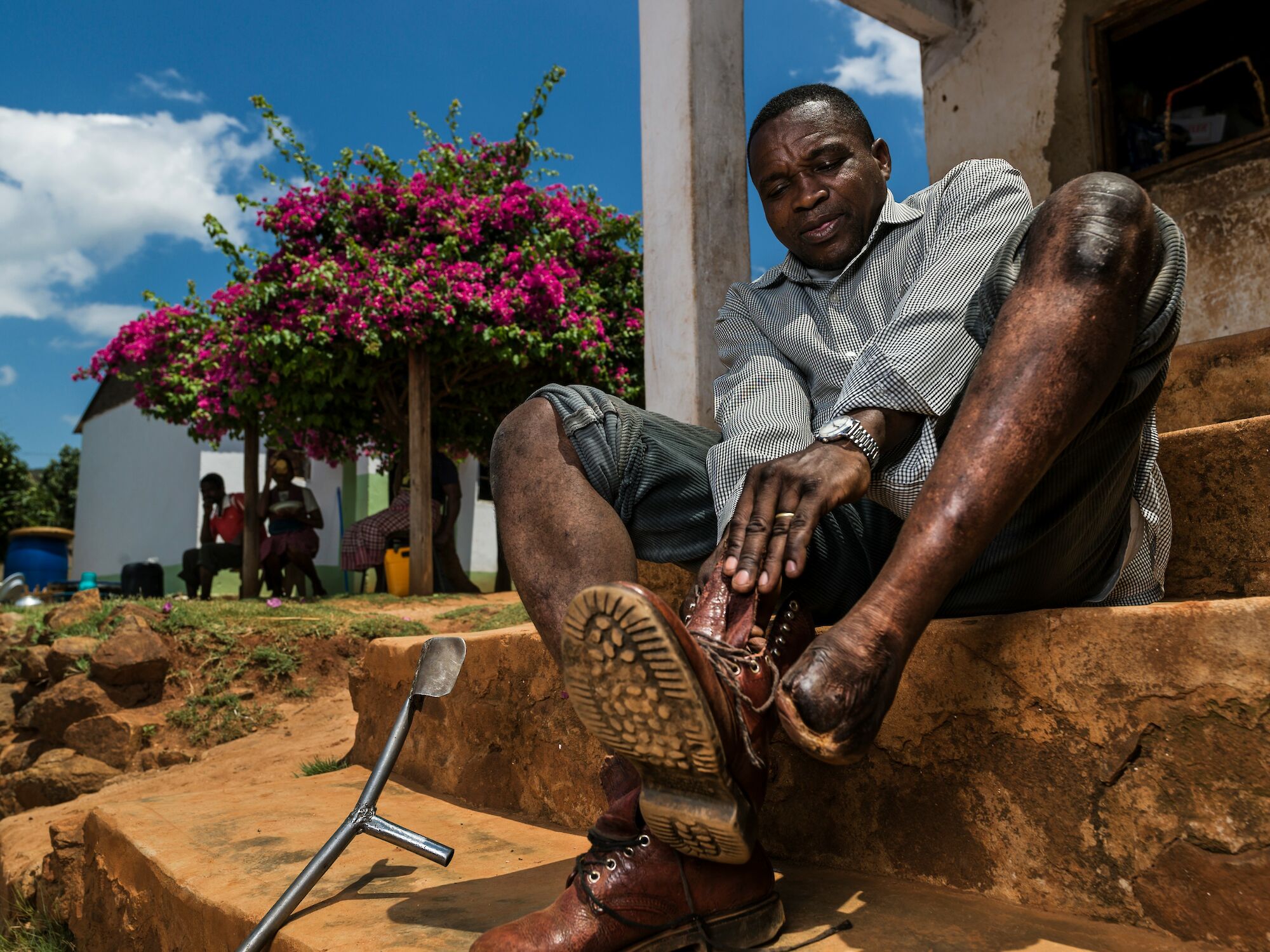 Long Limbs Prosthetics - An Interchangeable Prosthetic System for Long ...