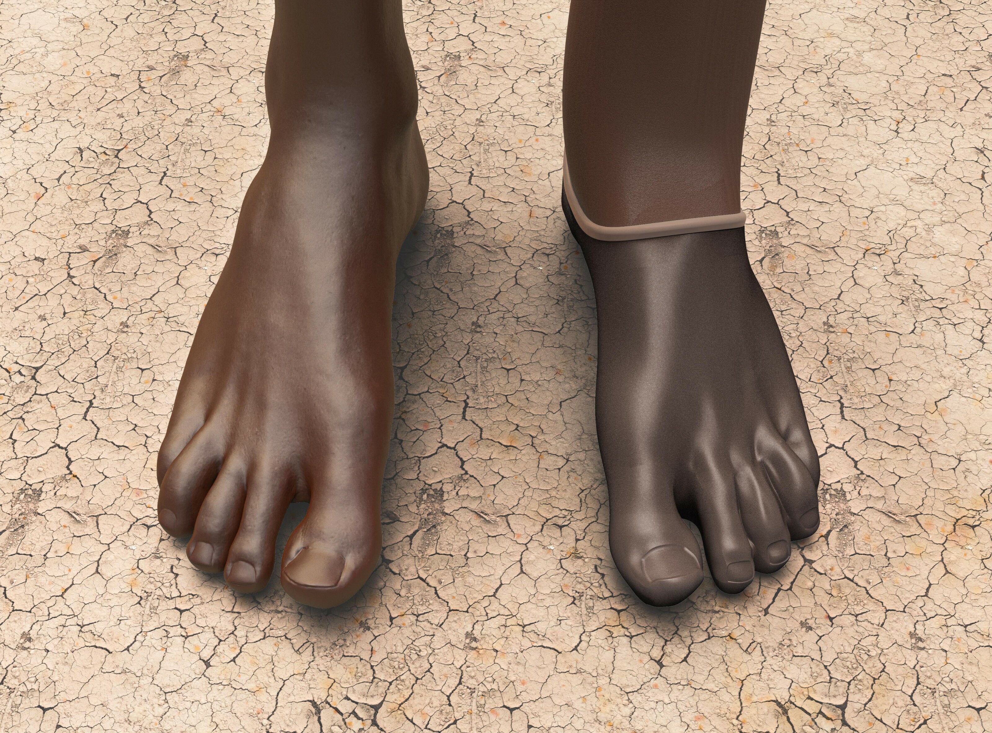 Long Limbs Prosthetics - An Interchangeable Prosthetic System for Long ...